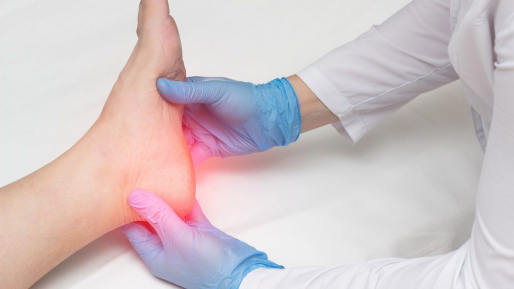 How Long is Recovery from Plantar Fasciitis Surgery? - the healthy hen How Long is Recovery from Plantar Fasciitis Surgery? - the healthy hen